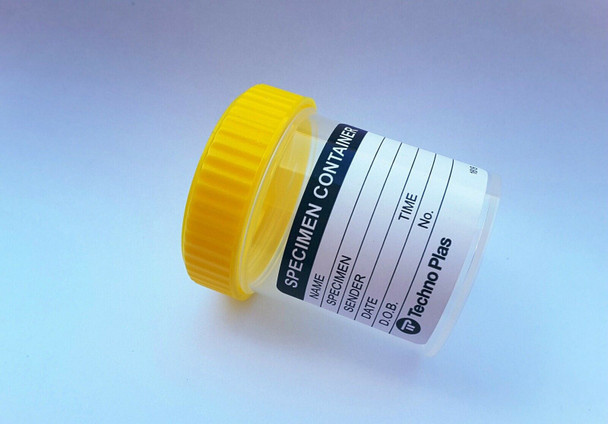Specimen Jar 70ml Label Yellow Cap Sterile Box 550 - SSS Australia ...