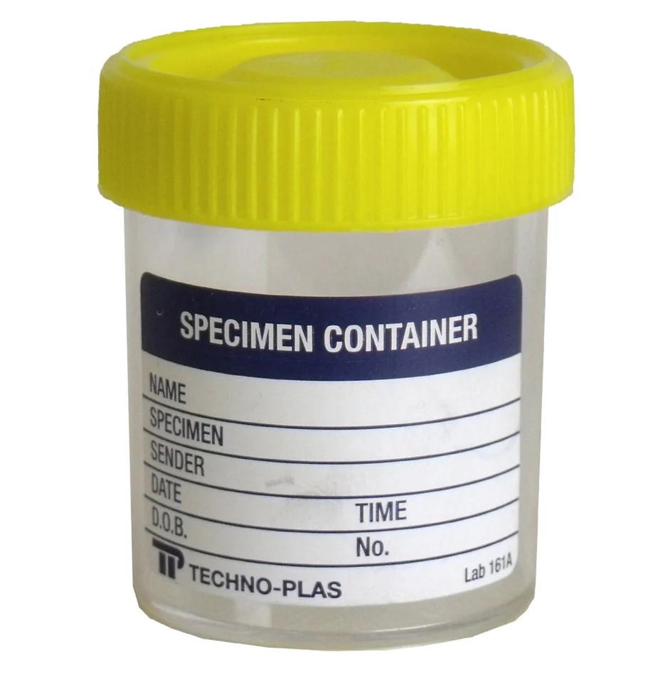 Specimen Jar Yellow Top (Labelled) - SSS Australia - SSS Australia ...
