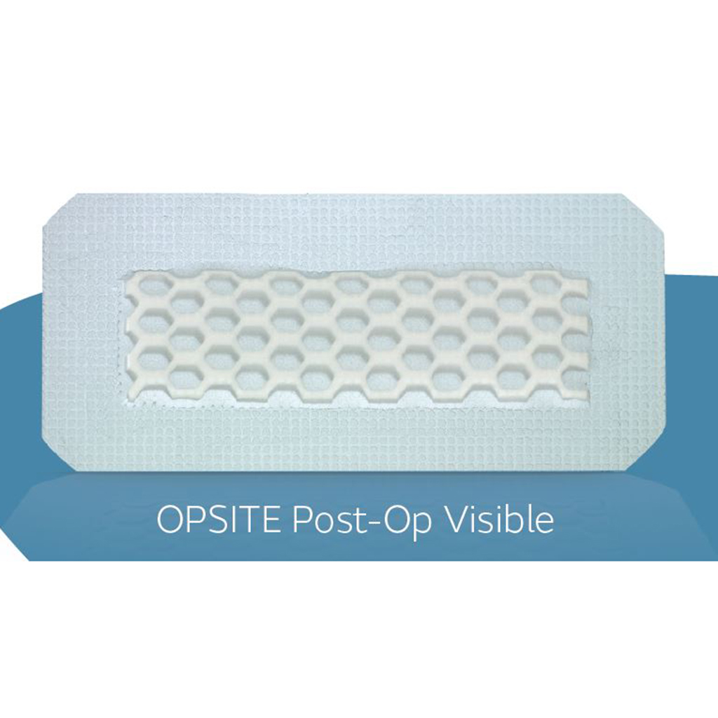 Opsite Post-Op Visible 20 x 10cm B20 - SSS Australia - SSS Australia ...