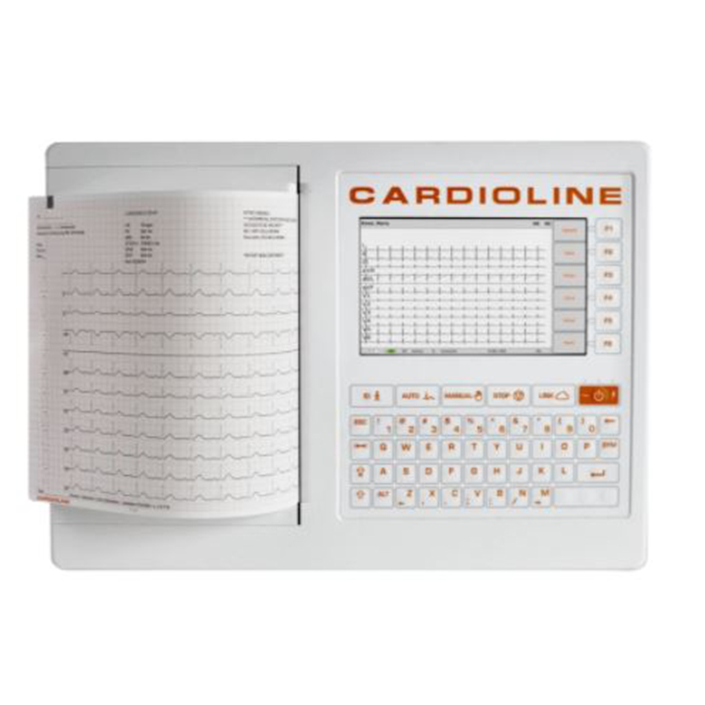 Cardioline ECG 200S A4 W- Glasow Interpretation and PDF - 3 - SSS ...